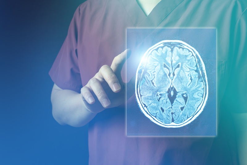 パーキンソン病治療の新たな可能性／高精度でアルツハイマー病を見抜く血液検査 - オーベン×ネーベン