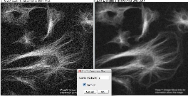 画像解析入門⑦ Image Jによる画像処理 - IMACEL Academy -人工知能・画像解析の技術応用に向けて-| エルピクセル株式会社