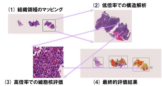 病理画像解析システム「e-Pathologist」 - IMACEL Academy -人工知能・画像解析の技術応用に向けて-| エルピクセル株式会社